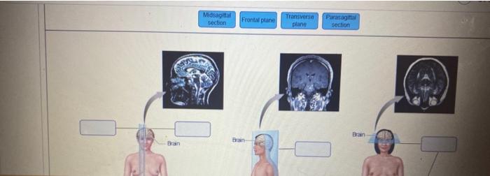 Solved please i need help with the right labelling (Correct | Chegg.com