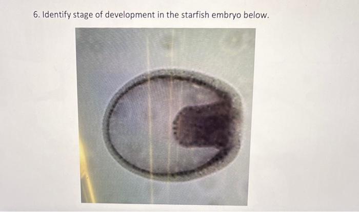 Solved 6. Identify stage of development in the starfish | Chegg.com