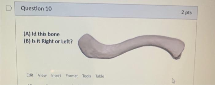 Solved (A) Id the Bony Landmark labeled "1" in Green. (B) | Chegg.com