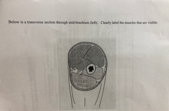 Solved Below is a transverse section through mid-brachium | Chegg.com