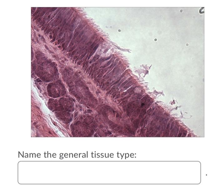 + 1. General tissue type: EPITHELIAL Specific tissue | Chegg.com