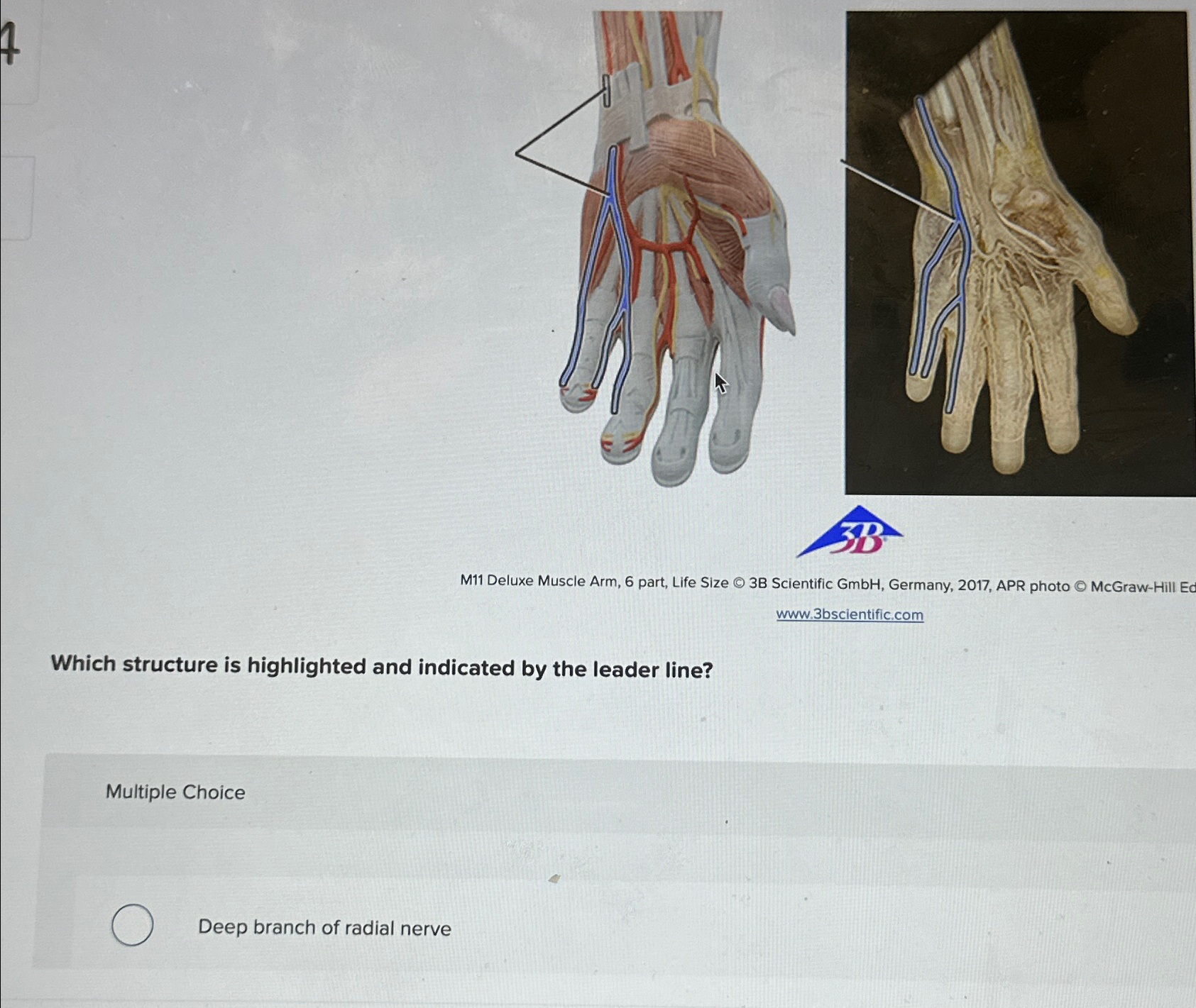 Solved M11 ﻿Deluxe Muscle Arm, 6 ﻿part, Life Size @ 3B | Chegg.com