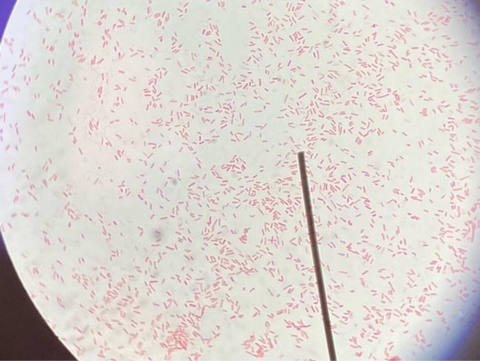 On these slides there are two different bacteria, | Chegg.com