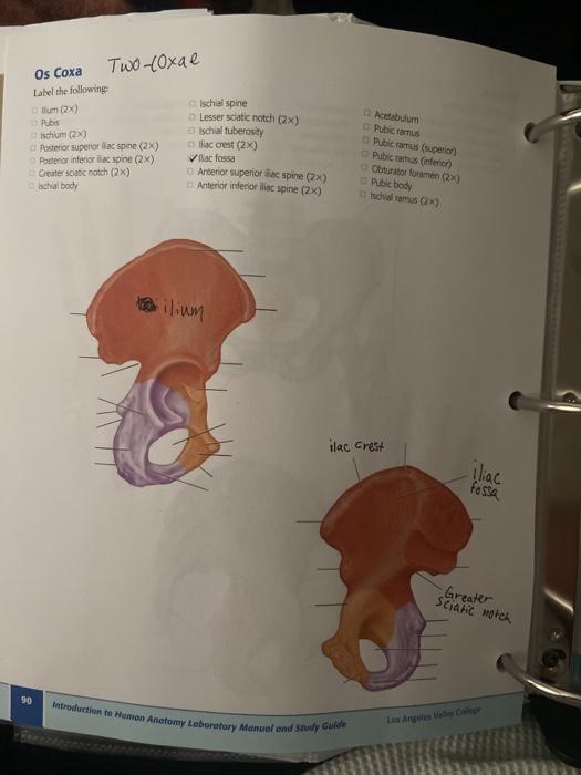 Solved TW-Oxae Os Cora Lawie Ich spise Lesser sciatic notch | Chegg.com