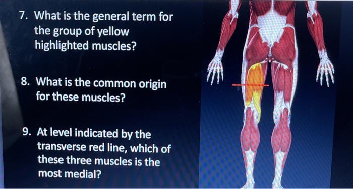 Solved 4. What muscle originates from the green highlighted | Chegg.com