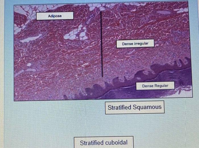 Solved Stratified Squamous Stratified cuboidal | Chegg.com