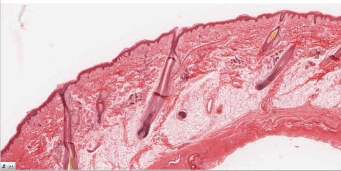 Solved Identify arrector pili muscle, sebaceous gland, sweat | Chegg.com