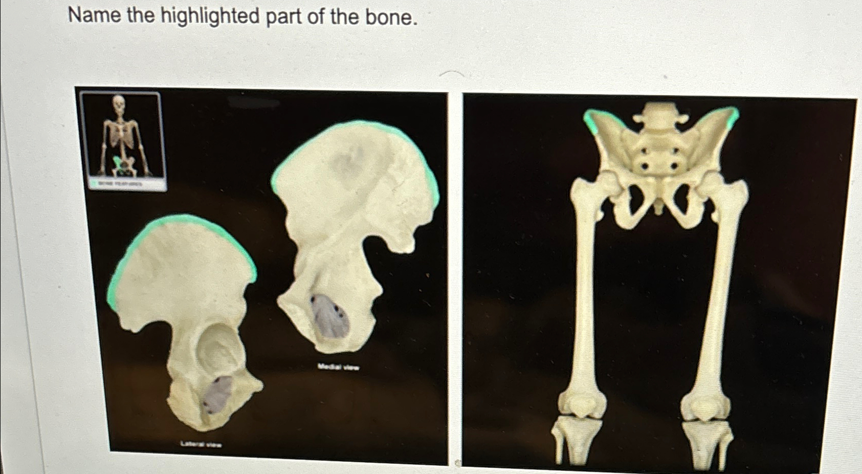 Solved Name the highlighted part of the bone. | Chegg.com