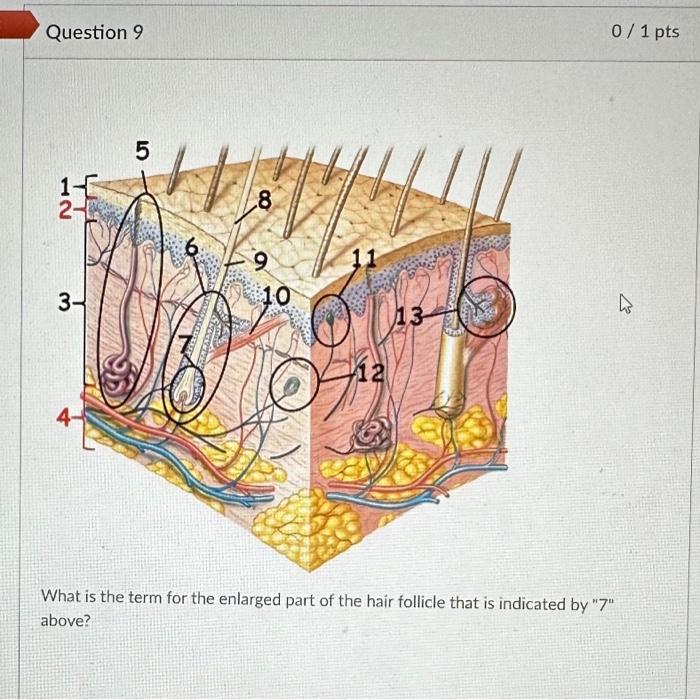 Solved What is the term for the enlarged part of the hair | Chegg.com