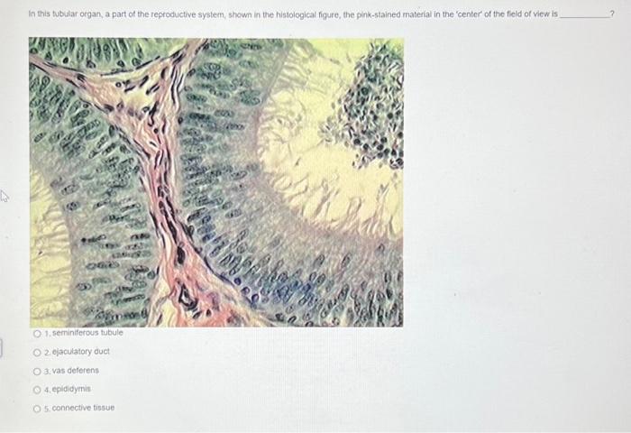 Solved in this tubular organ, a part of the reproductive | Chegg.com