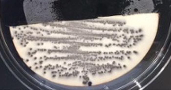 Solved what is the result of this esculin id membrane test? | Chegg.com