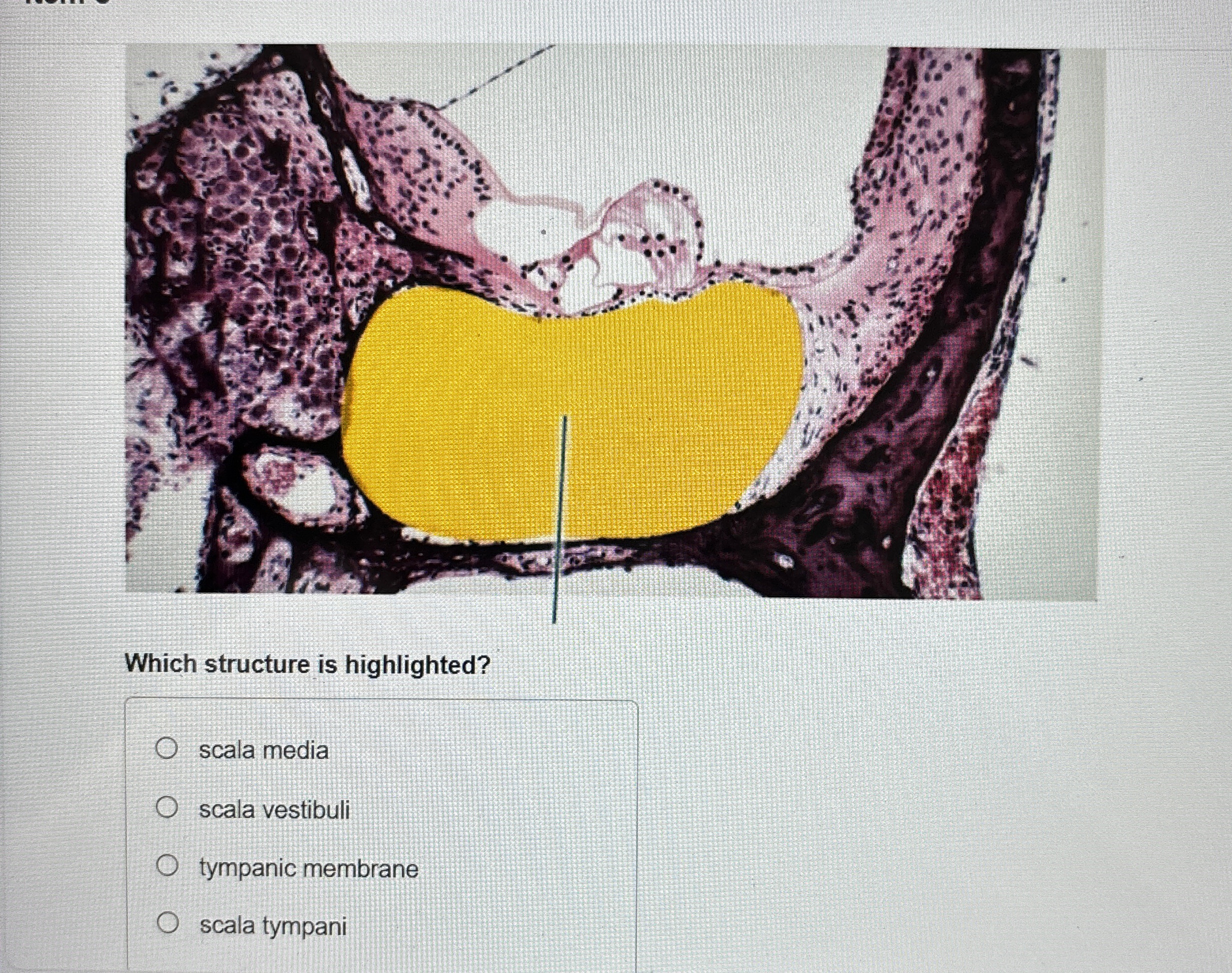 Solved Which structure is highlighted?scala mediascala | Chegg.com
