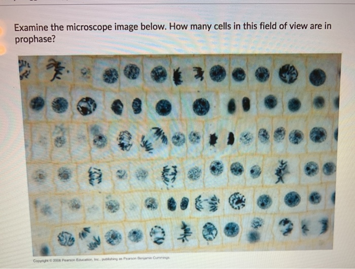 Solved Examine the microscope image below. How many cells in | Chegg.com