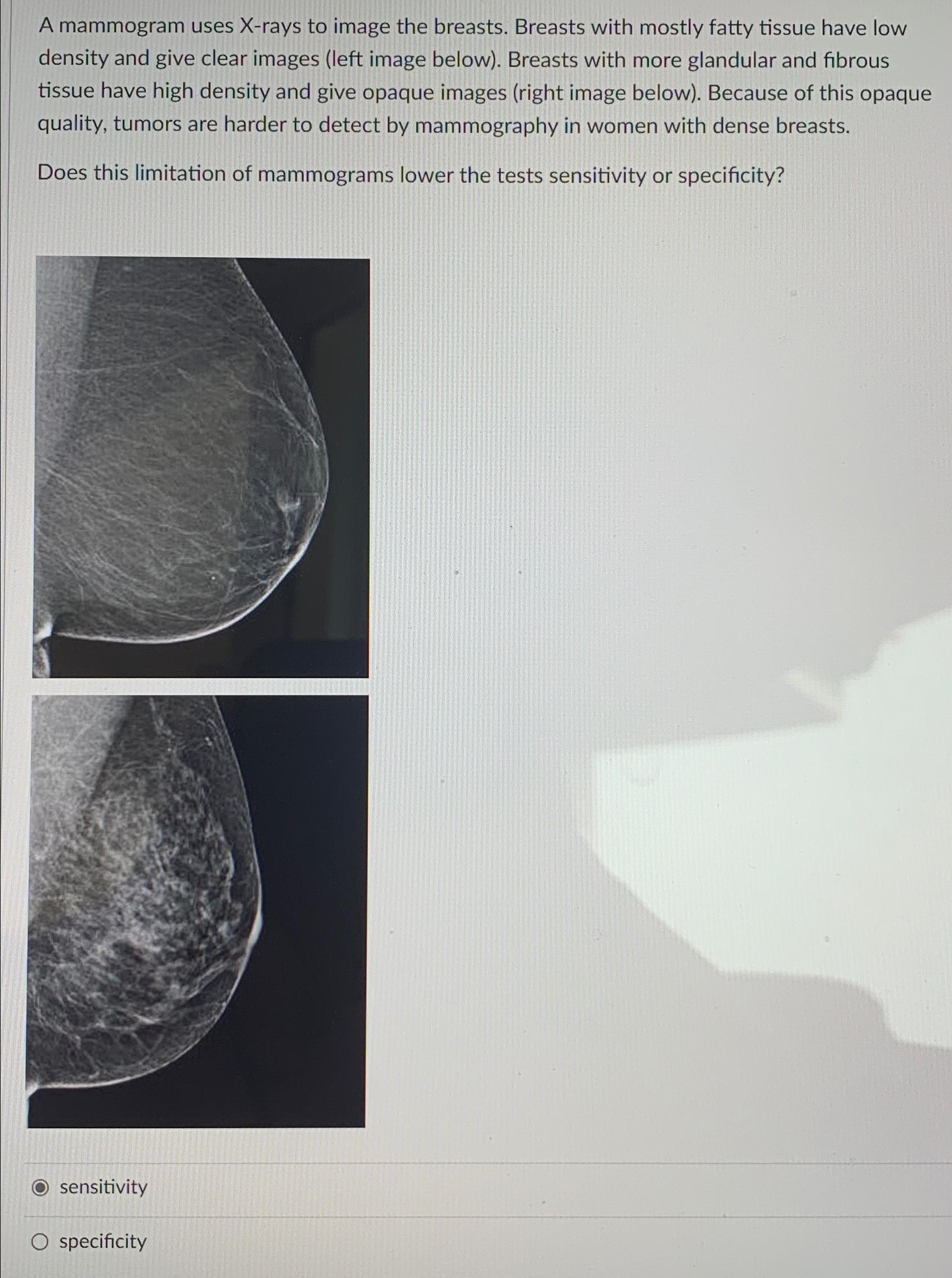 Solved A mammogram uses x-rays to image the breasts. Breasts | Chegg.com