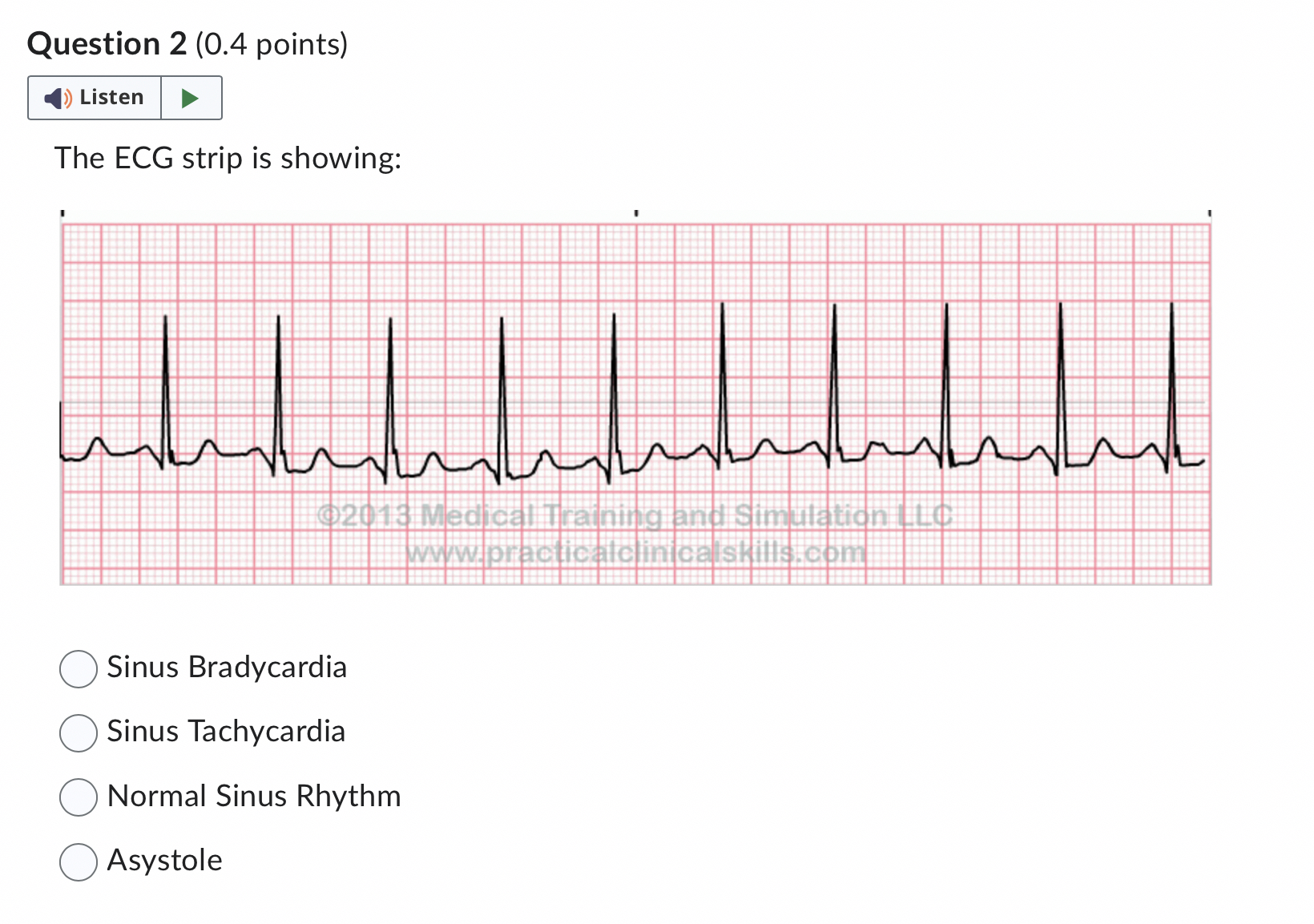 Solved Question 2 (0.4 ﻿points)ListenThe ECG strip is | Chegg.com