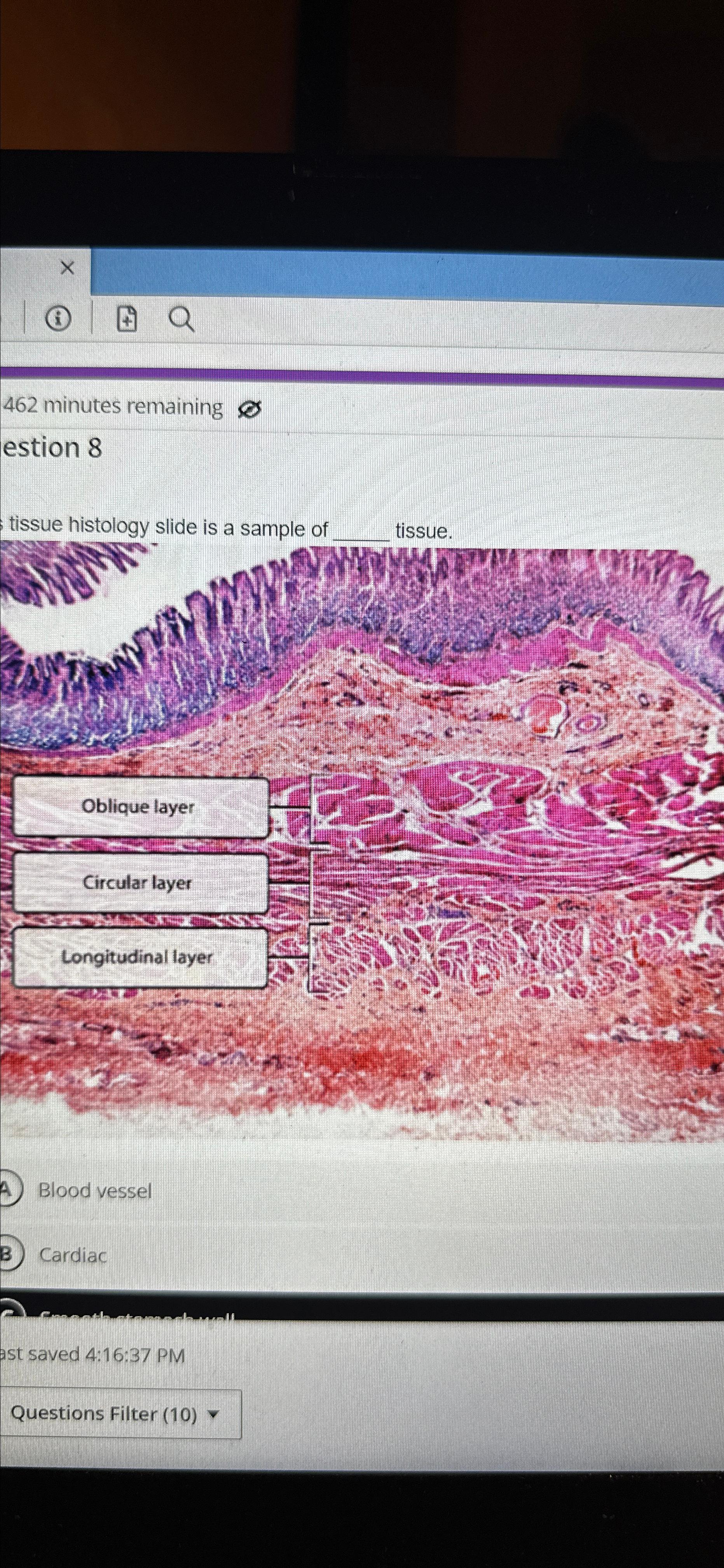 Solved 462 ﻿minutes remaining O? ﻿estion 8tissue histology | Chegg.com