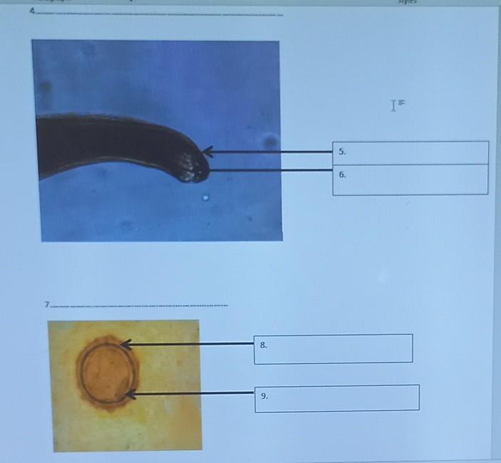 Solved IDENTIFY AND LABEL THE FOLOWING PARASITES 1 3. | Chegg.com Solved IDENTIFY AND LABEL THE FOLOWING PARASITES 1 3. | Chegg.com