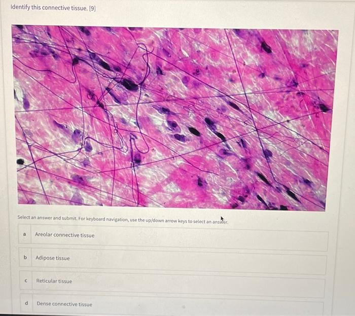 Solved Identify this connective tissue. (9) Select an answer | Chegg.com