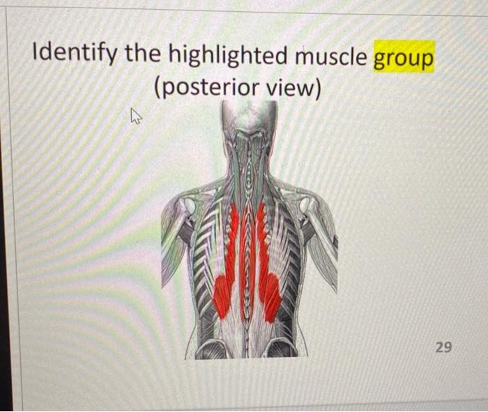 Solved Identify the highlighted muscle group (posterior | Chegg.com