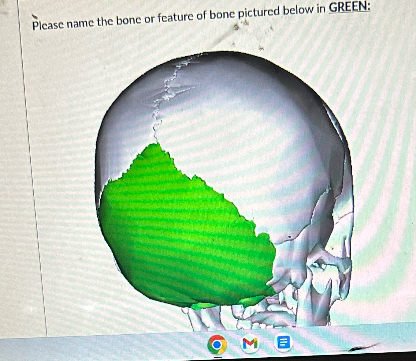 Solved Please name the bone or feature of bone pictured | Chegg.com