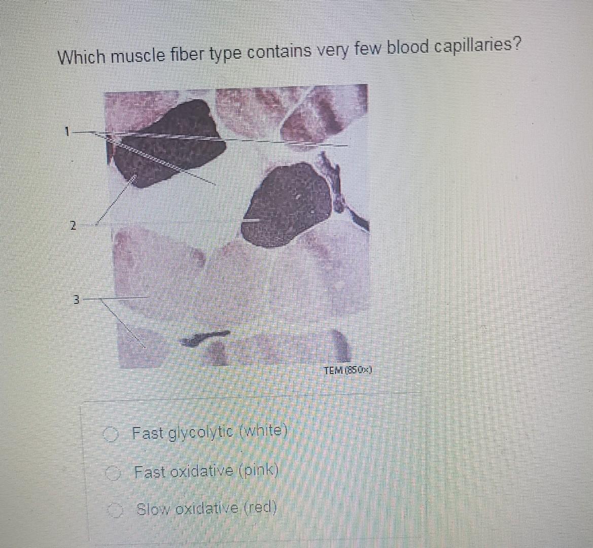 Solved Which muscle fiber type contains very few blood | Chegg.com