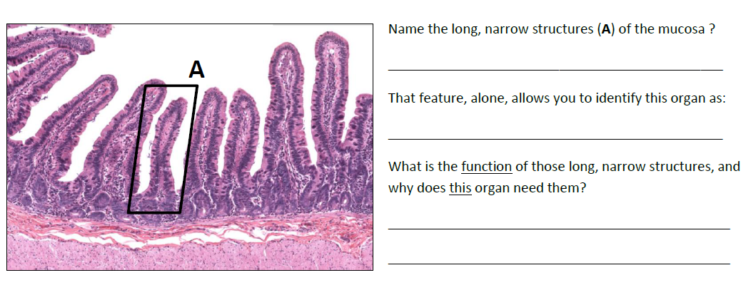 Solved Name the long, narrow structures (A) ﻿of the | Chegg.com