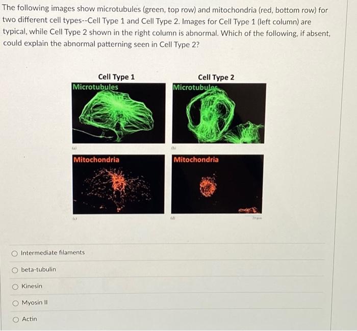 Solved The image below is an electron micrograph showing | Chegg.com