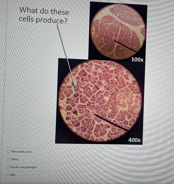Solved Organ? 100x 400x O Parotid salivary gland Pancreas O | Chegg.com