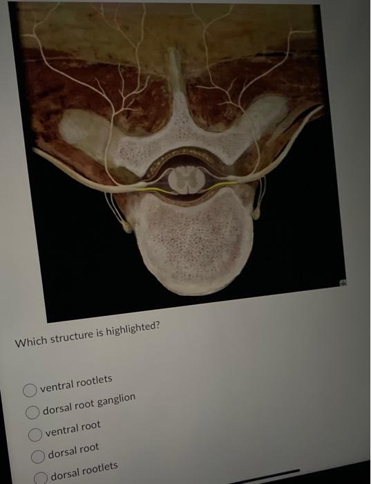 Solved Which structure is highlighted? ventral rootlets | Chegg.com