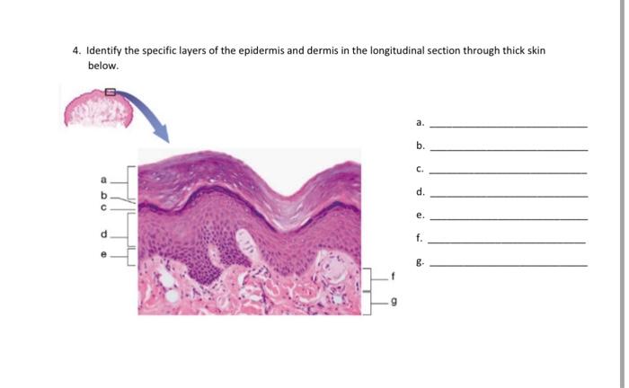 Solved 4. Identify the specific layers of the epidermis and | Chegg.com