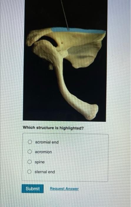 Solved Which structure is highlighted? O acromial end O | Chegg.com