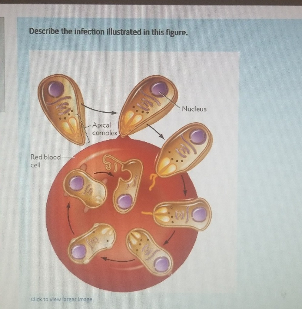 Solved Describe the infection illustrated in this figure. | Chegg.com