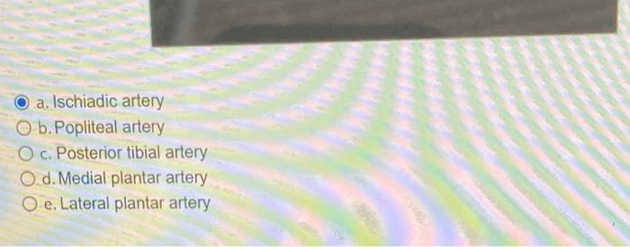 Solved Identify the structure marked in the Figure above. X | Chegg.com