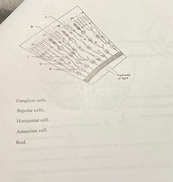 Solved Ganglion cells. Bipolar cells. Horizontal cell. | Chegg.com