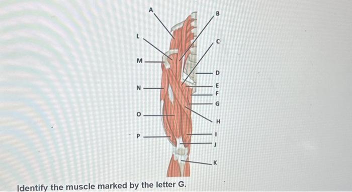 Solved Identify the muscle marked by the letter G.Identify | Chegg.com