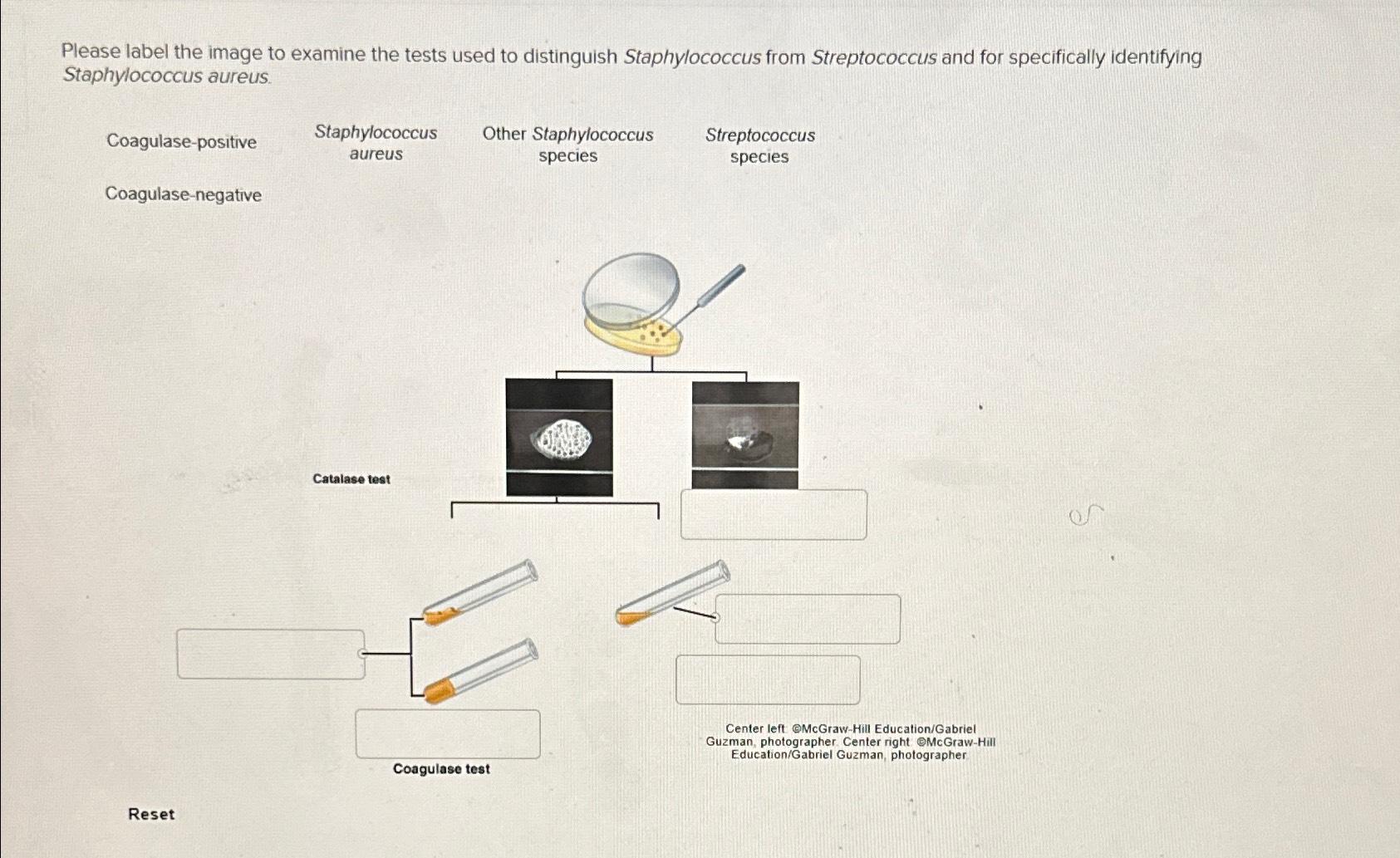 Solved Please label the image to examine the tests used to | Chegg.com