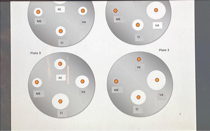 Figure 4. Diagram of how to measure a zone of | Chegg.com