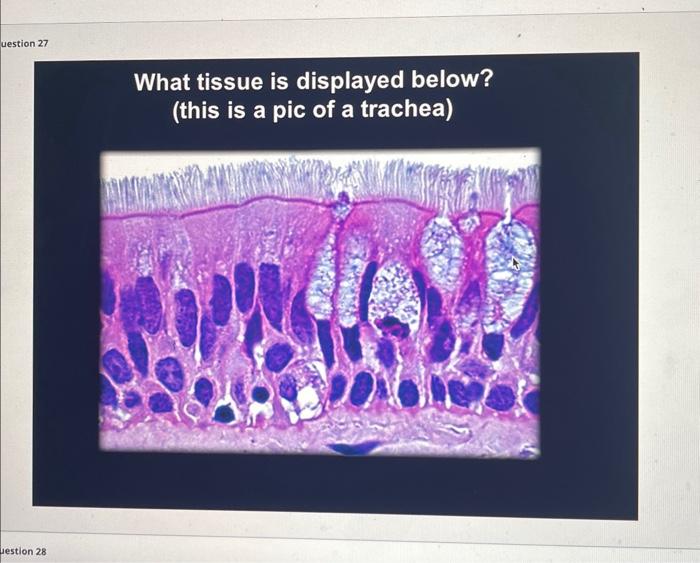 Solved What tissue is displayed below? (this is a nic of a | Chegg.com