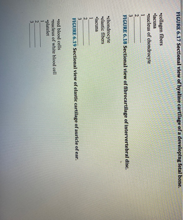 Solved lipid storage area nucleus of adipocyte 2 FIGURE 6.12 | Chegg.com