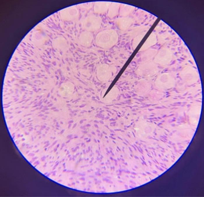Label Oocyte Nuclei, Follicle, The antrum, Primary | Chegg.com