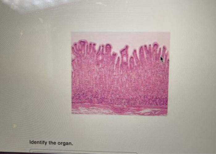 Solved Identify the organ. Identify the highlighted | Chegg.com Solved Identify the organ. Identify the highlighted | Chegg.com