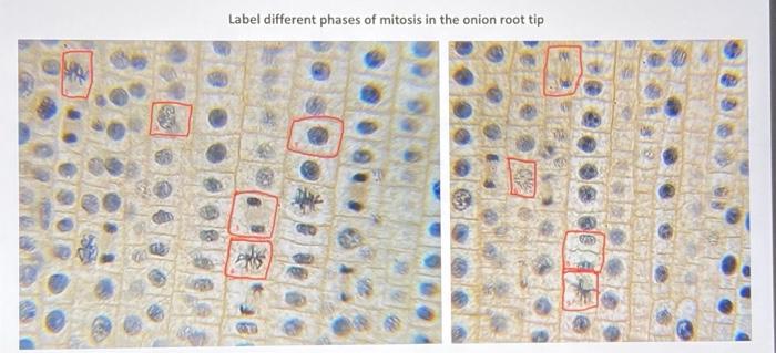 Solved Label different phases of mitosis in the onion root | Chegg.com
