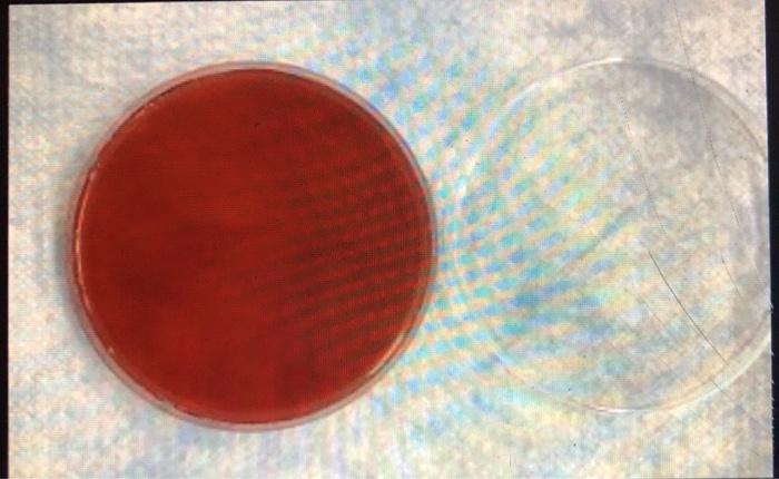 Solved MacConkey Agar results:MacConkey Agar uninoculated | Chegg.com