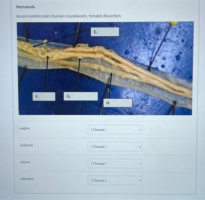 Solved Ascaris lumbricoides (human roundworm, male) | Chegg.com