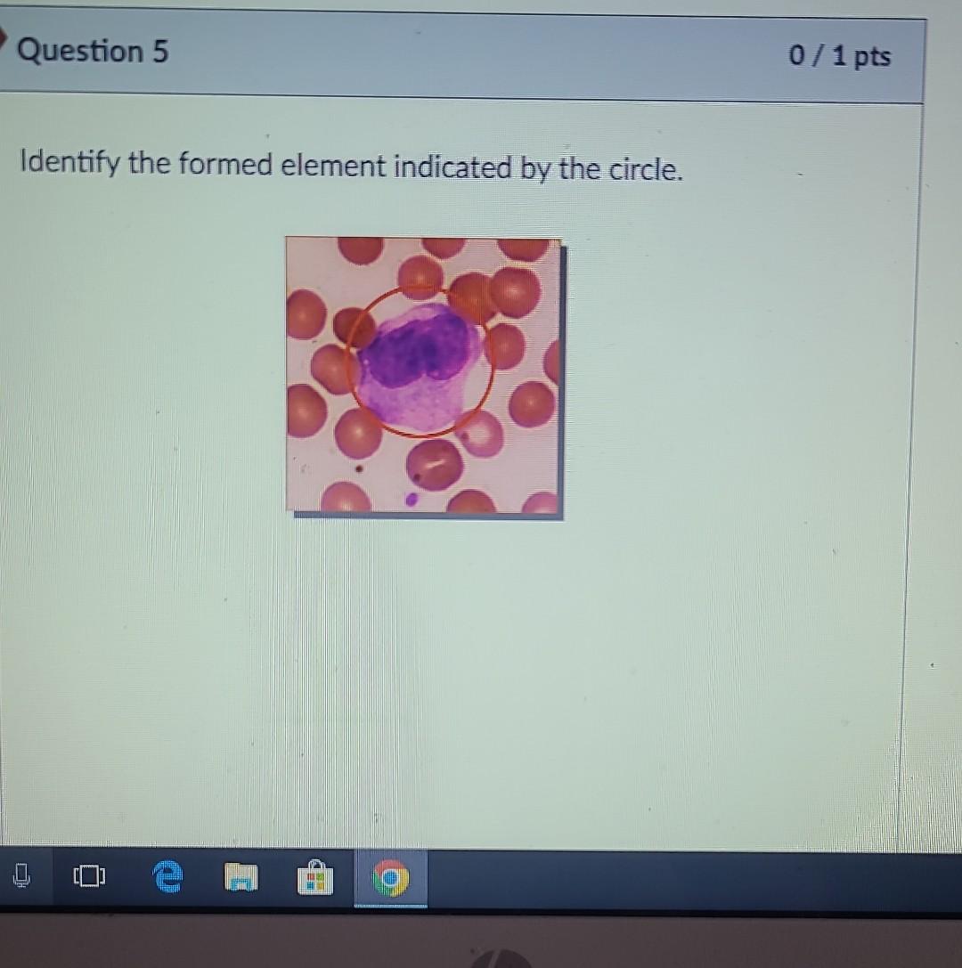 Solved Identify the formed element indicated by the circle. | Chegg.com