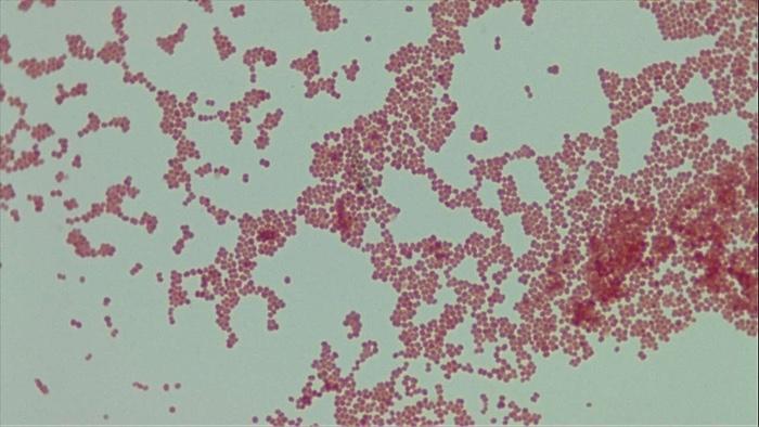 Solved Gram Strain Report the Gram reaction. Describe the | Chegg.com