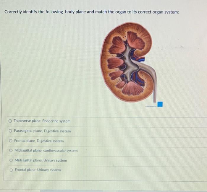 Solved Correctly identify the following body plane and match | Chegg.com