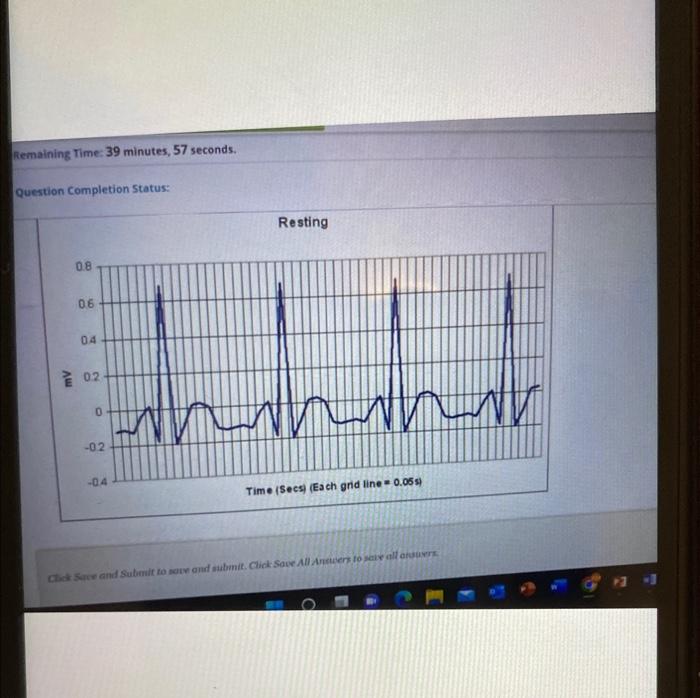Solved Using the 'resting' chart provided calculate the | Chegg.com