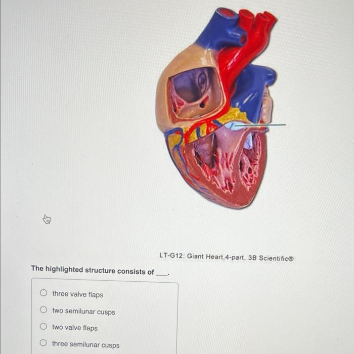 Solved Model courtesy of Denoyer-Geppert, www.denoyer.com | Chegg.com
