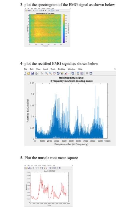 For The Following Emg Signal Write A Matlab Code To